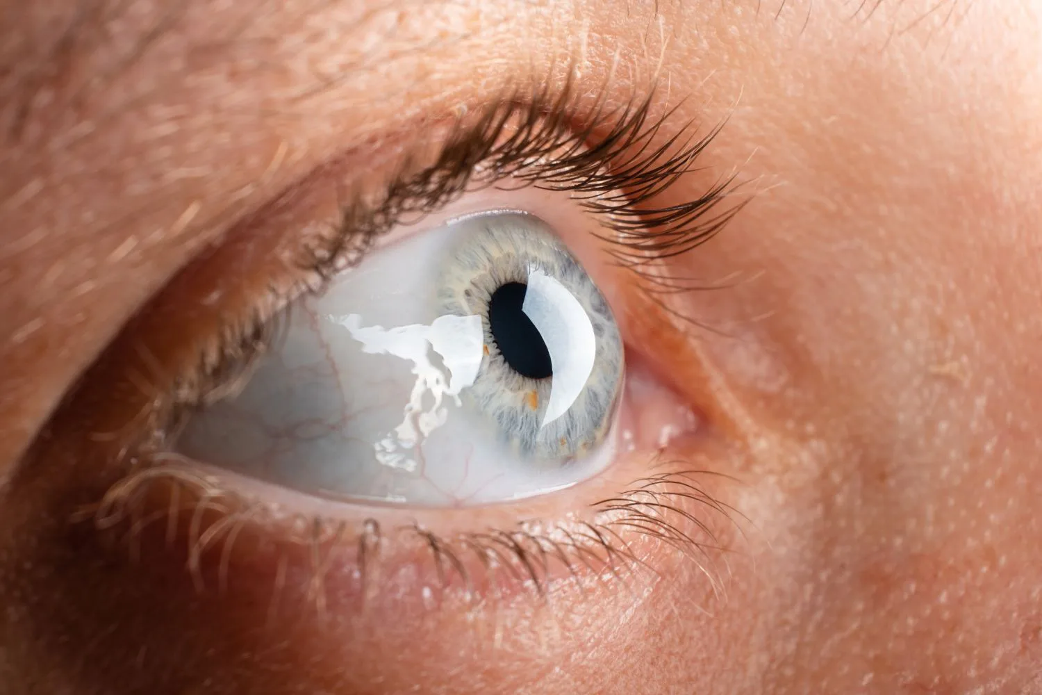 Augendiagnose - was in den Augen zu lesen ist